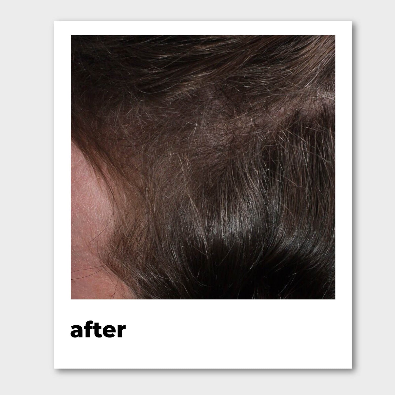 NANOGEN HAIR GROWTH FACTOR SERUM – Nanogen